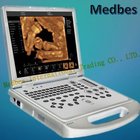Portable 4D Color Doppler Ultrasound Scanner supplier