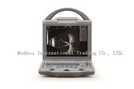 Full digital A/B scan portable cheapest Ophthalmic Ultrasound supplier