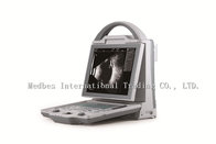 High Accuracy Portable Ophthalmic A B Scan Ultrasound Machine supplier