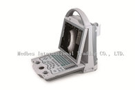 Top Sale Laptop Ophthalmic AB Mode Ultrasound Scanner Equipment supplier