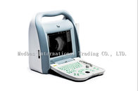 best selling ab scan a cheap ophthalmic ultrasound  Eye machine supplier