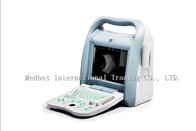 High Accuracy Portable Ophthalmic A B Scan Ultrasound Machine supplier
