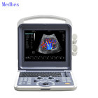 Abdomen, gynecology, obstetrics, cardiology, small parts, urolog Ultrasound Machine supplier