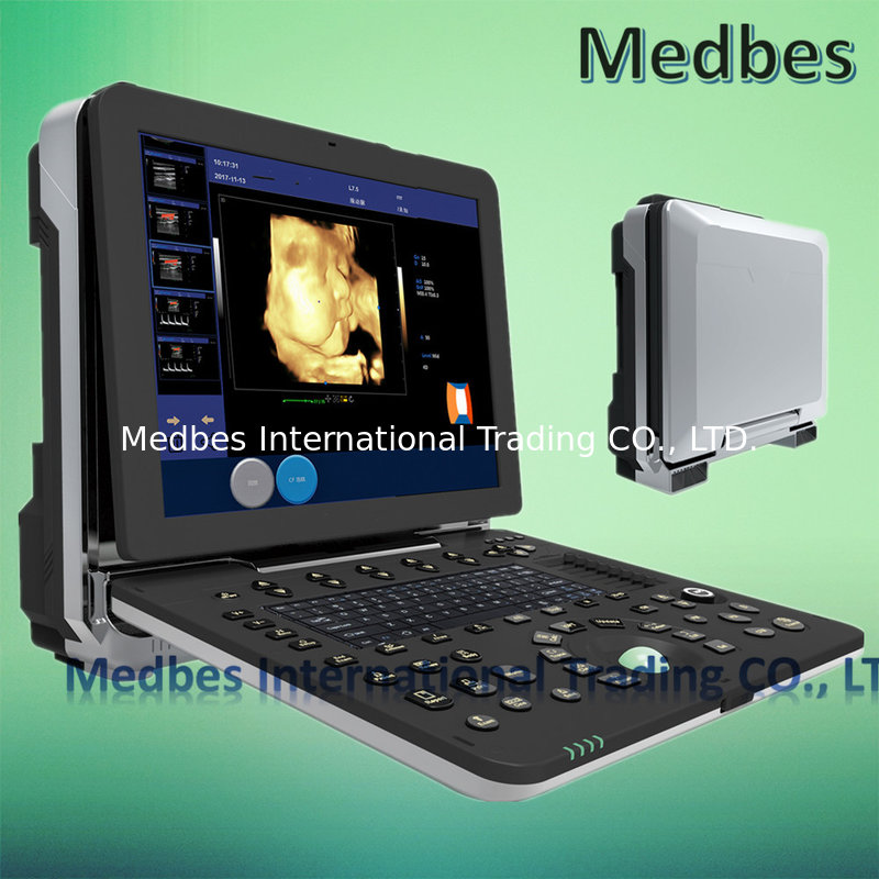Windows 4D Portable  Color Doppler Ultrasound Scanner  Ultrasound System Scanner supplier