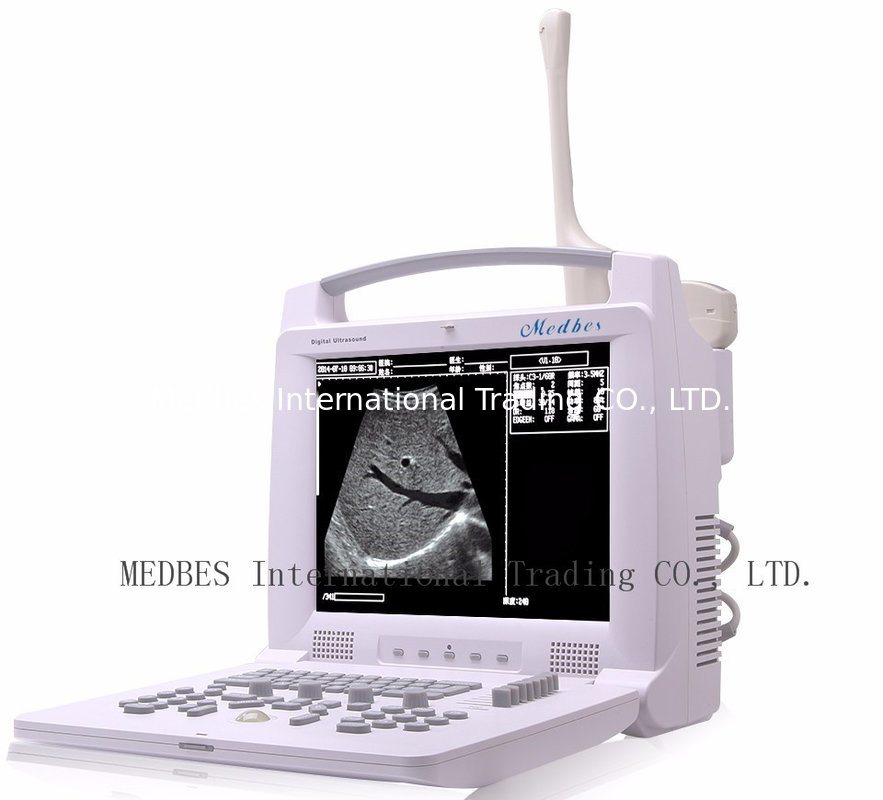 Labtop Ultrasound Scanner Machine with 2 connectors supplier