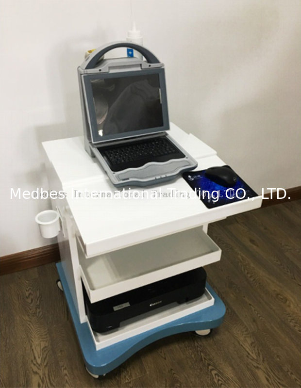 Automatic High Effective Portable Ultrasound Bone Densitometer with Built-in Printer supplier