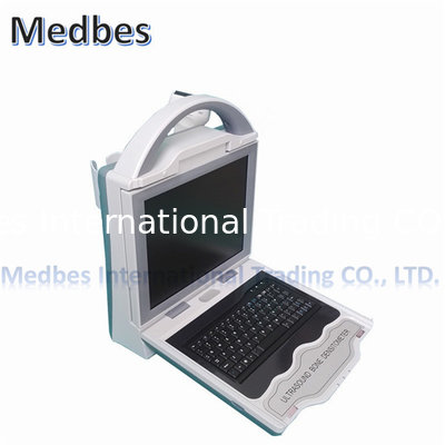 Portable Bone Density Checking Machine Automatic High Effective Portable Ultrasound supplier