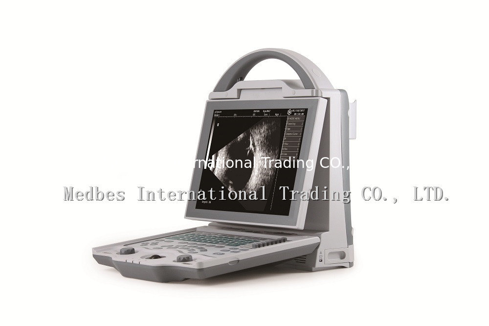 Full digital A/B scan portable cheapest Ophthalmic Ultrasound supplier